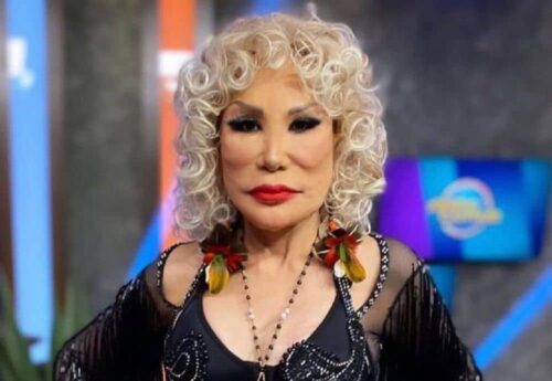 Lyn May’s Plastic Surgery Destroyed Her Face - Before And After