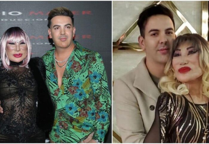 Lyn May’s Plastic Surgery Destroyed Her Face - Before And After