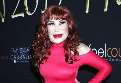 Lyn May’s Plastic Surgery Destroyed Her Face - Before And After