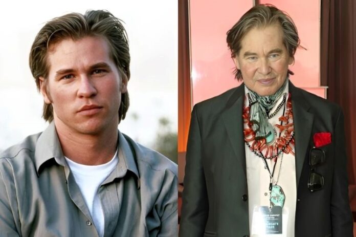 Val Kilmer Plastic Surgery: Unveiling the Transformation