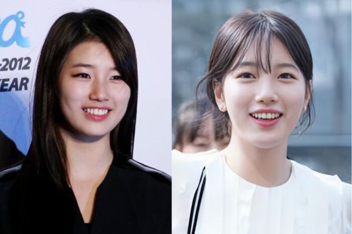 Bae Suzy Plastic Surgery: Did She Tweak Her Rabbit Teeth?