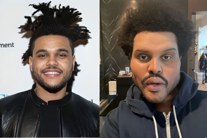 The Weeknd Plastic Surgery: A Facial Transformation Unveiled
